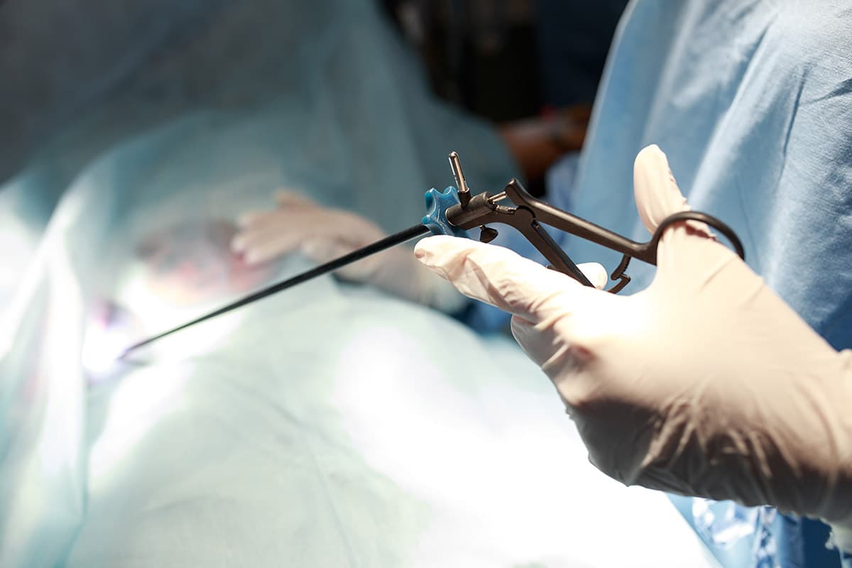 Appendectomy in Singapore: Key Information to Know - Surgicare ...